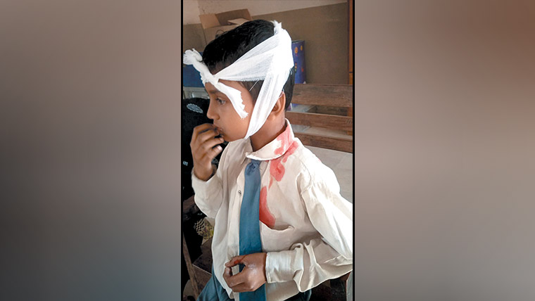 شہر کی دنیا:-سرکاری اسکول کی چھت کا پلستر گرنے سے طالبعلم زخمی